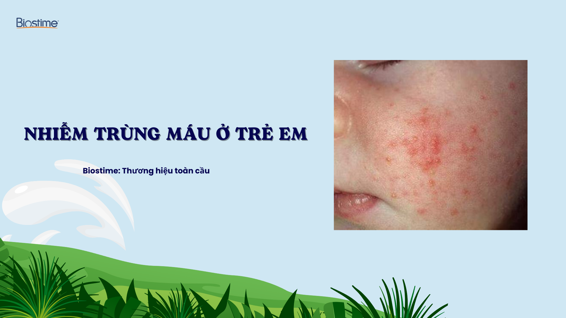 Cách ngăn ngừa biến chứng nguy hiểm khi bé bị nhiễm trùng máu